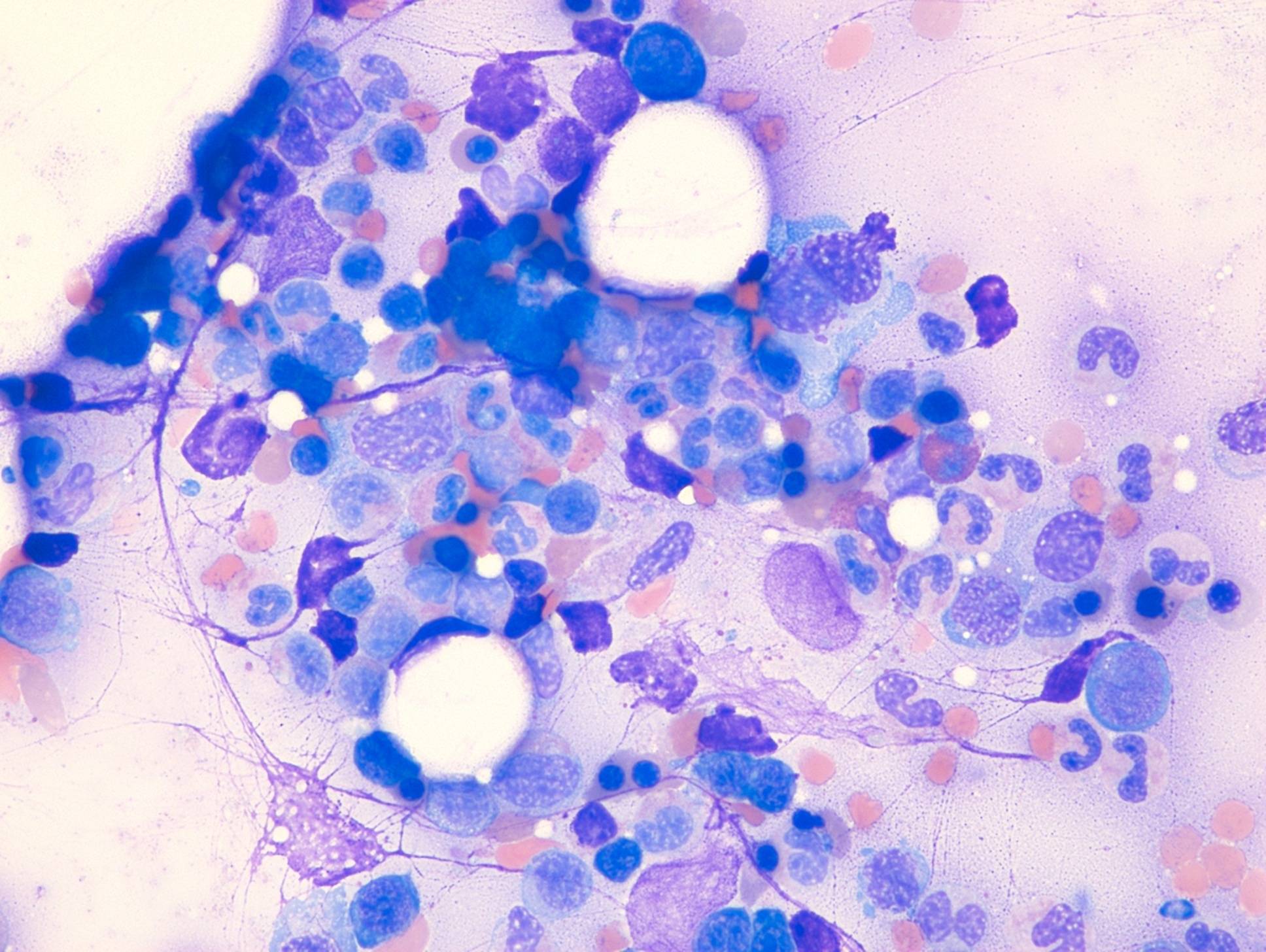 MLS Overview : Medical Laboratory Science Program : Texas State University